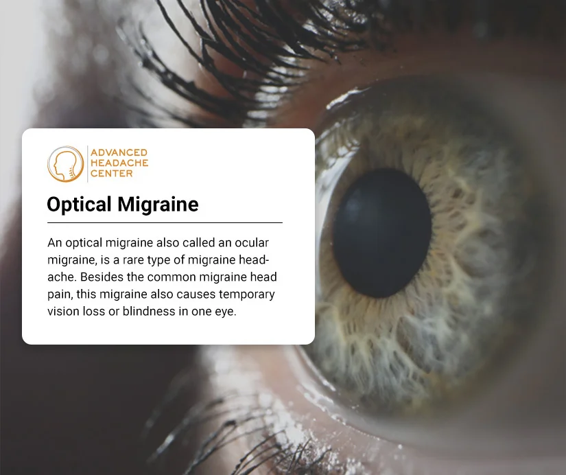 Ocular Migraines What They Look Like